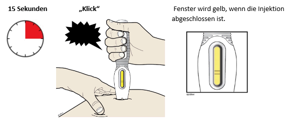Evenity Injektionslösung 105mg/1.17ml Fertpen 2 Stück in der Adler Apotheke